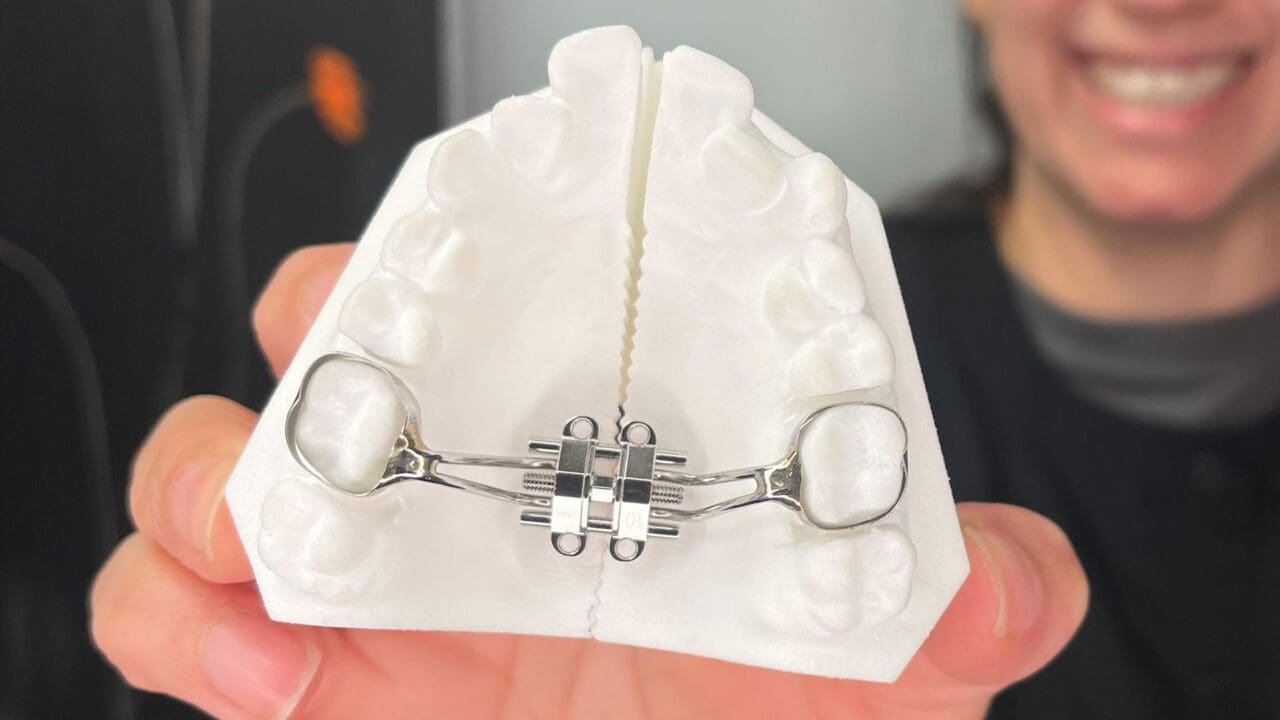 The Importance of Interceptive Orthodontics - Dr. Hadi Daia, DDS