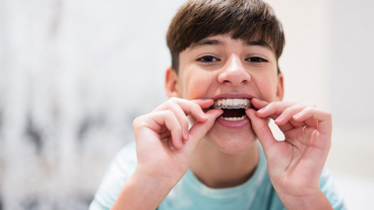 Comprehensive Guide to Interceptive Orthodontics